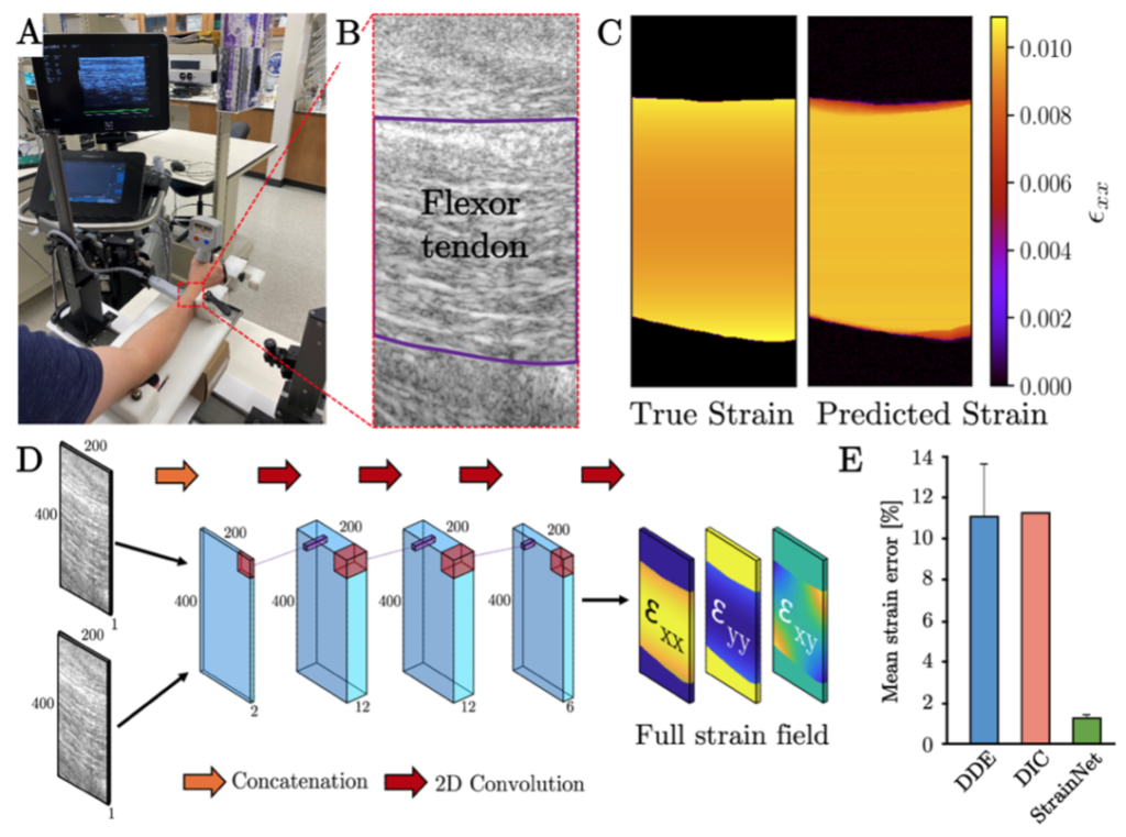 Machine learning for in vivo soft tissue strain prediction - Berkeley ...